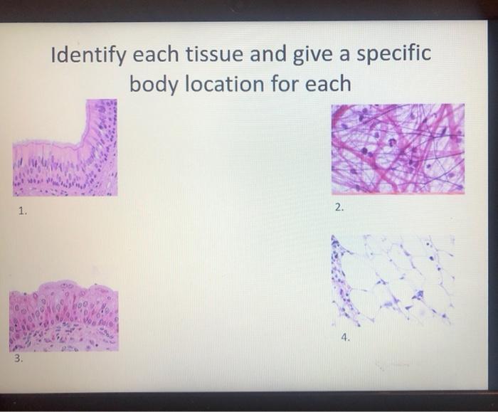 Solved Identify each tissue and give a specific body | Chegg.com