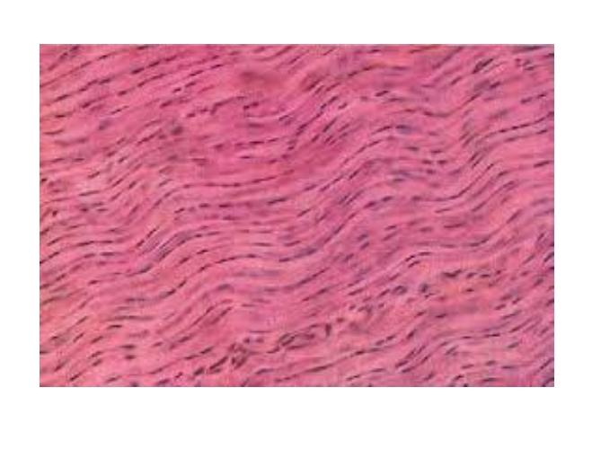 Solved Tissue