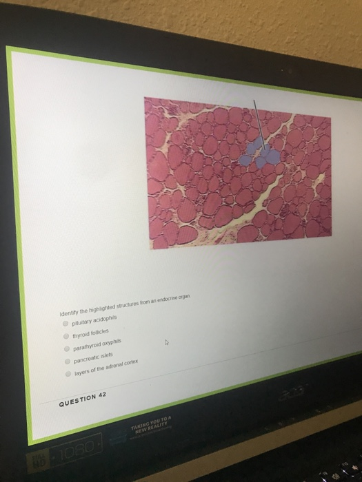 Solved Identify the highlighted structures from an endocrine | Chegg.com