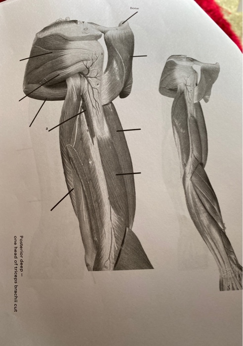 Solved Posterior deep - one head of triceps brachii cut | Chegg.com