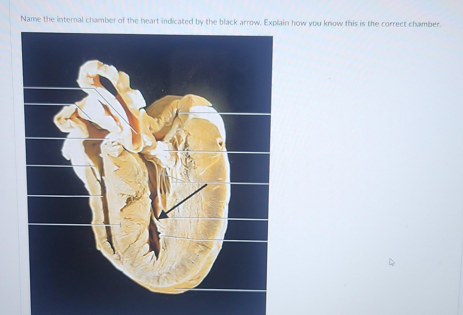 Solved Name the internal chamber of the heart indicated by | Chegg.com