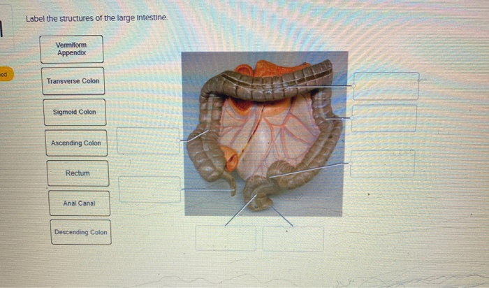 Solved Label the structures of the large intestine. | Chegg.com