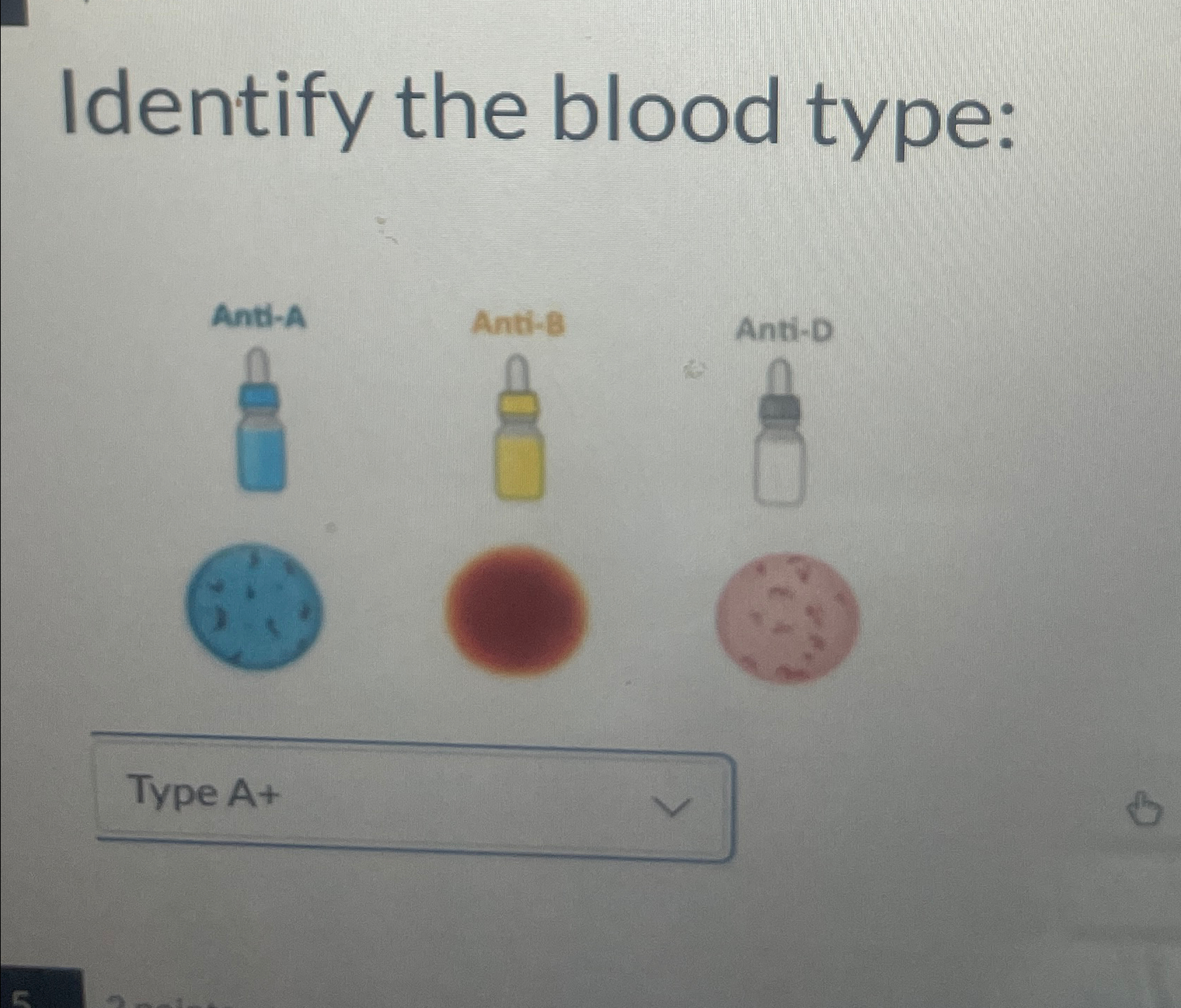Solved Identify the blood type:Anti-AAnti-8Anti-D | Chegg.com