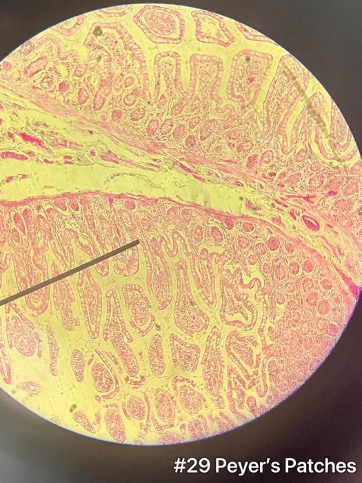 Solved Completely label the figures belowFigure 1. | Chegg.com