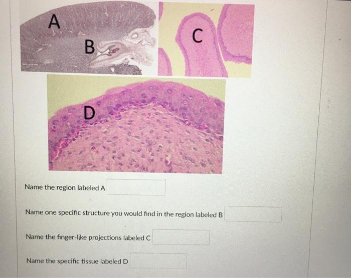 Solved С 3L B A. D Name the pouch-like structure labeled A | Chegg.com