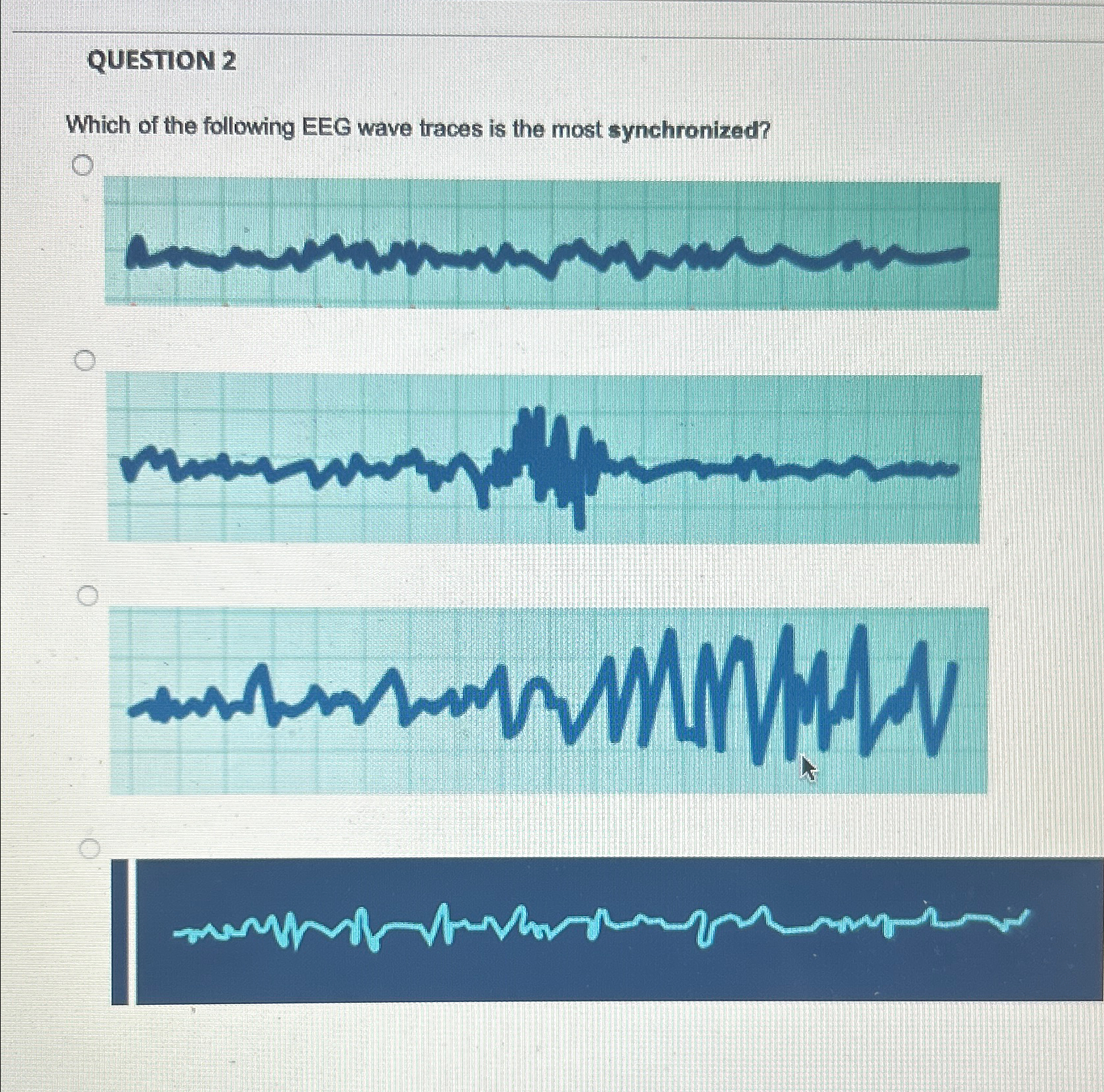 Solved QUESTION 2Which of the following EEG wave traces is | Chegg.com