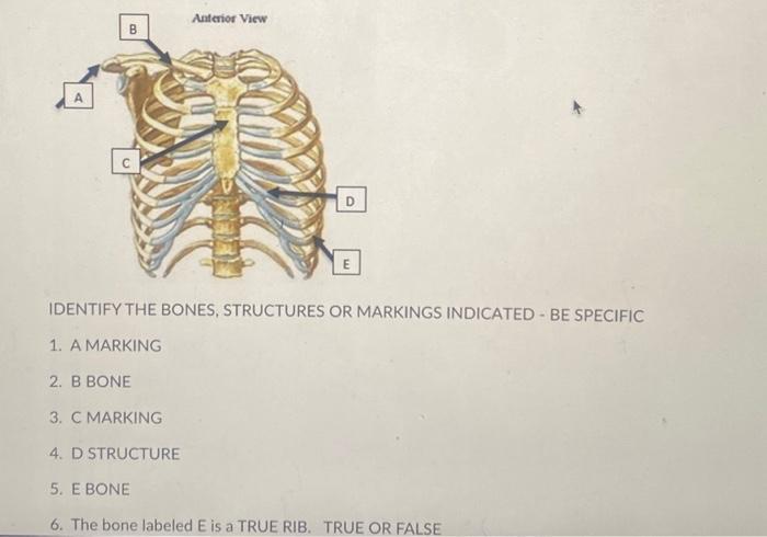 Solved IDENTIFY THE BONES, STRUCTURES OR MARKINGS INDICATED | Chegg.com