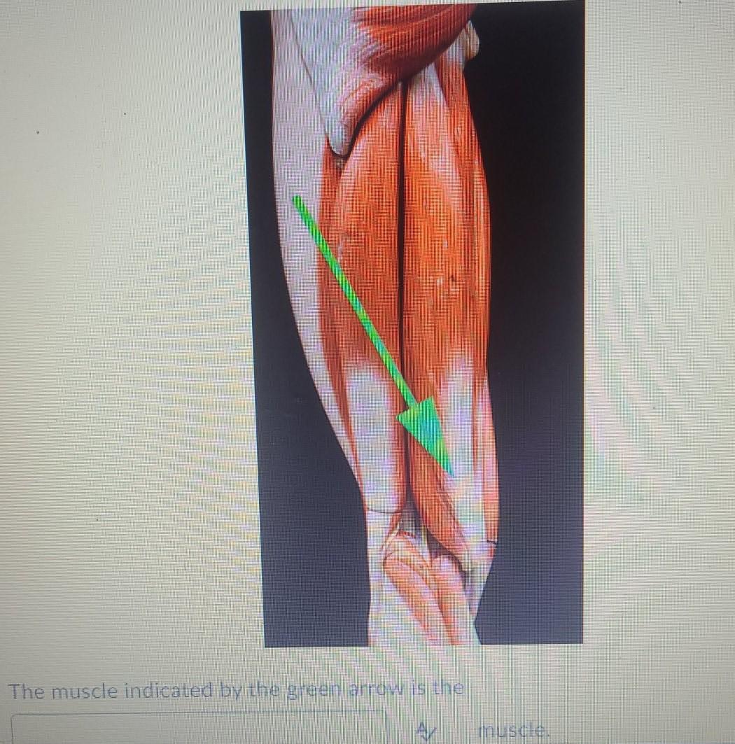 Solved The muscle indicated by the green arrow is the | Chegg.com
