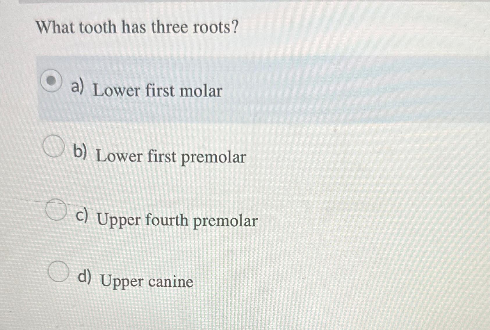 Solved What tooth has three roots?a) ﻿Lower first molarb) | Chegg.com