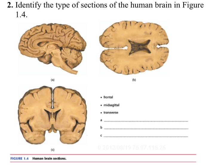 Solved 1. Label Figure 1.1, with the appropriate anatomical | Chegg.com