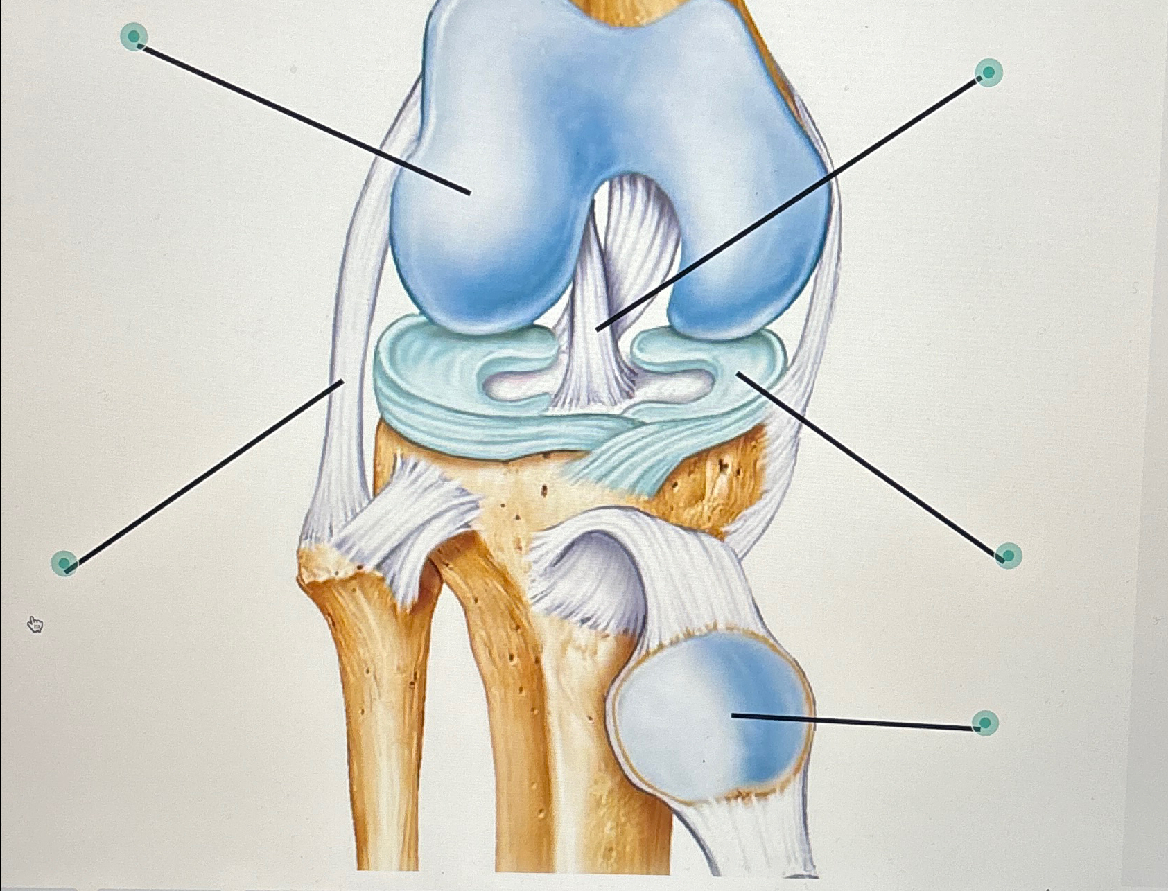 Solved Label the structures of the knee joint.Use the | Chegg.com