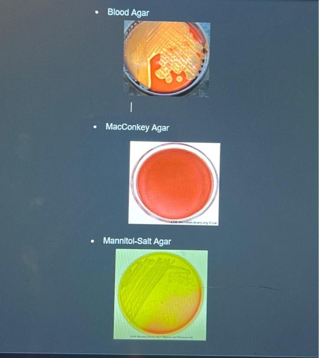 Solved Record your observations of Staphylococcus aureus | Chegg.com