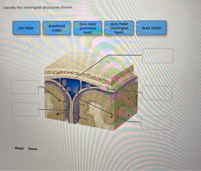 Identify The Meningeal Structures Shown Identify The Meningeal Structures Shown