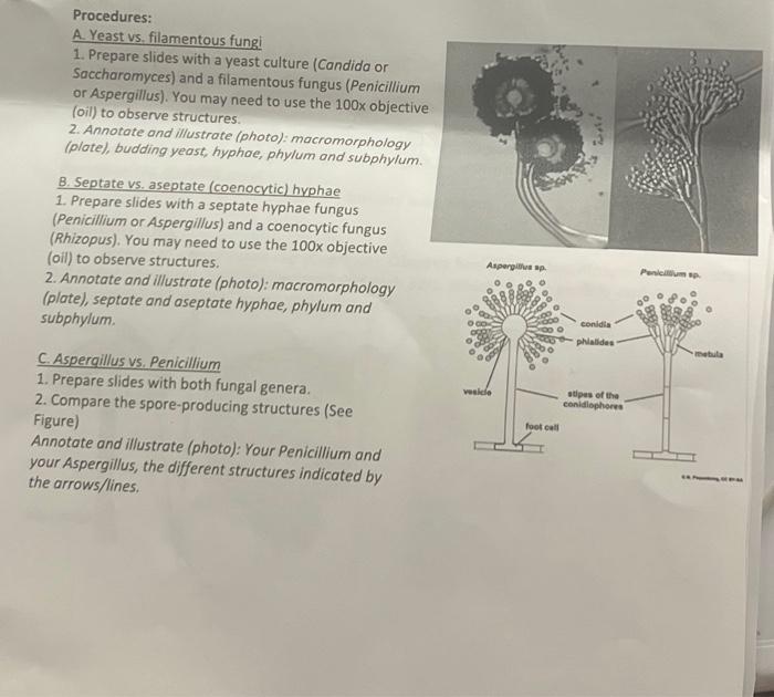 Solved Procedures: A. Yeast vs. filamentous fungi 1. Prepare | Chegg.com