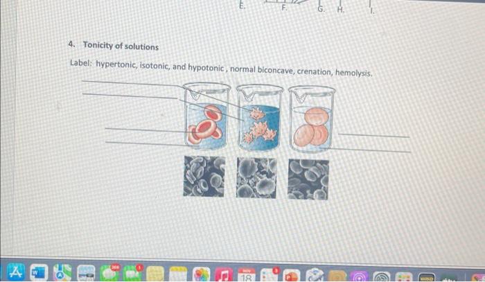 Solved 4. Tonicity of solutions Label: hypertonic, isotonic, | Chegg.com