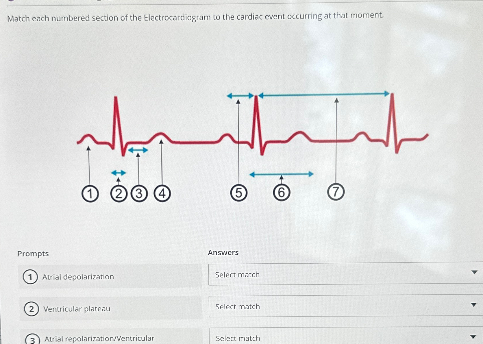Solved Match each numbered section of the Electrocardiogram | Chegg.com