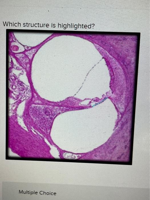 Solved Which structure is highlighted? Multiple Choice | Chegg.com