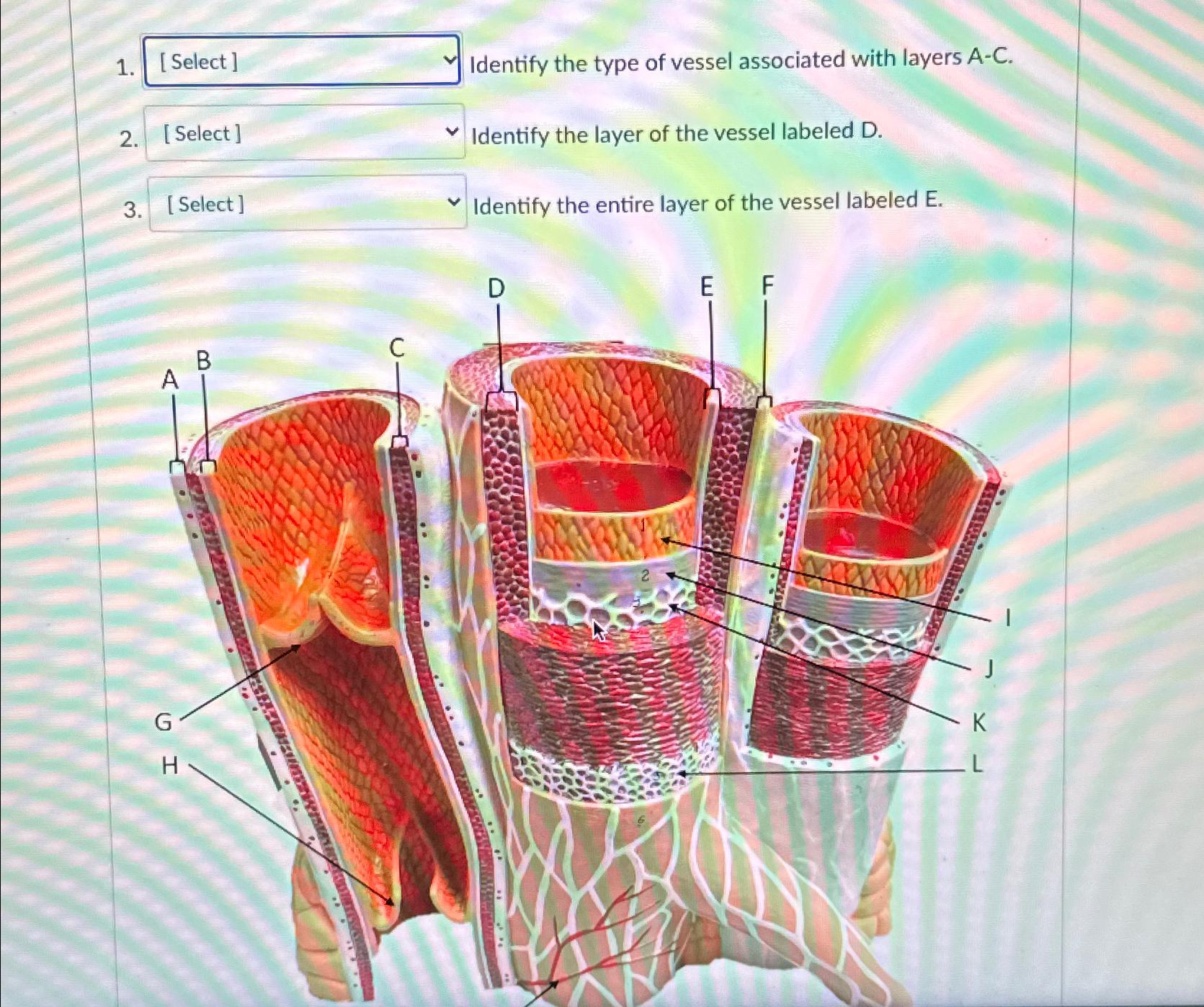 Solved Identify the type of vessel associated with layers | Chegg.com