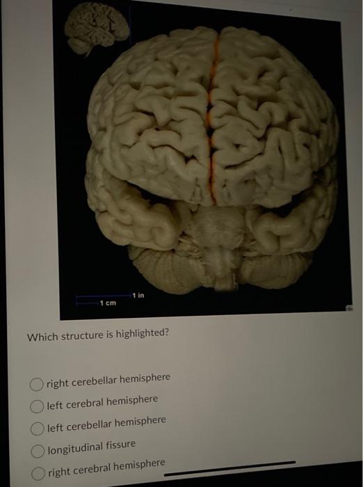Solved Which structure is highlighted? longitudinal fissure | Chegg.com