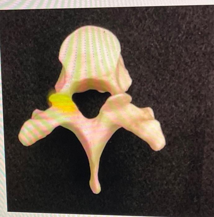 Solved Name the bone | Chegg.com
