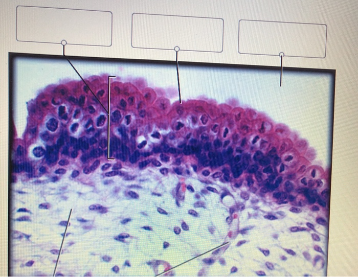 Solved Epithelium Lacuna Of Bladder Umbrella Cell Dense