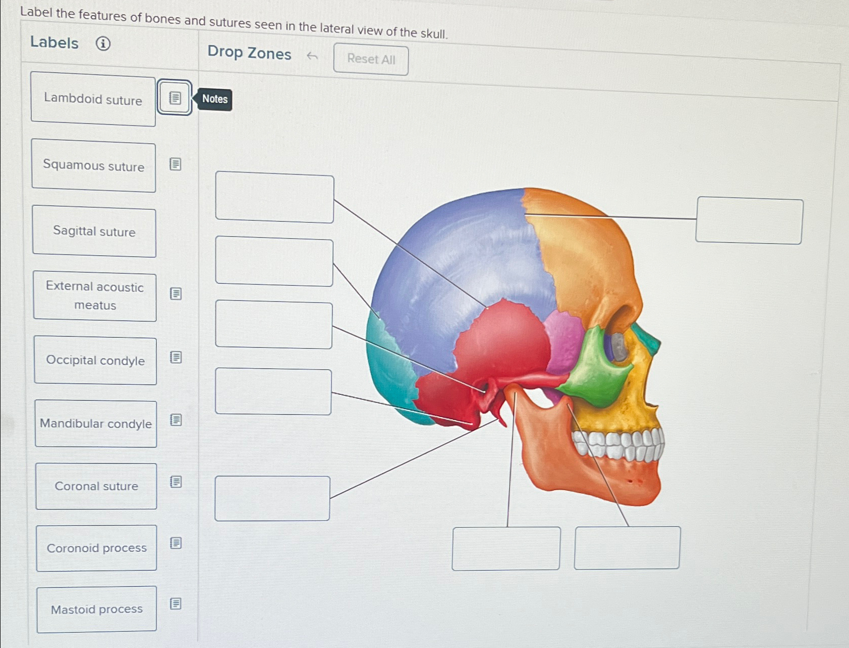 Solved Label the features of bones and sutures seen in the | Chegg.com