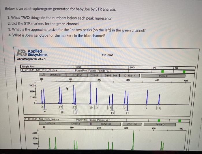Solved Below is an electropherogram generated for baby Joe | Chegg.com