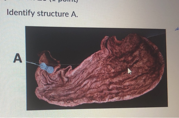 Solved POL) Identify structure A. | Chegg.com