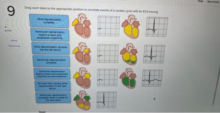 Solved Drag Each Label To The Appropriate Position To