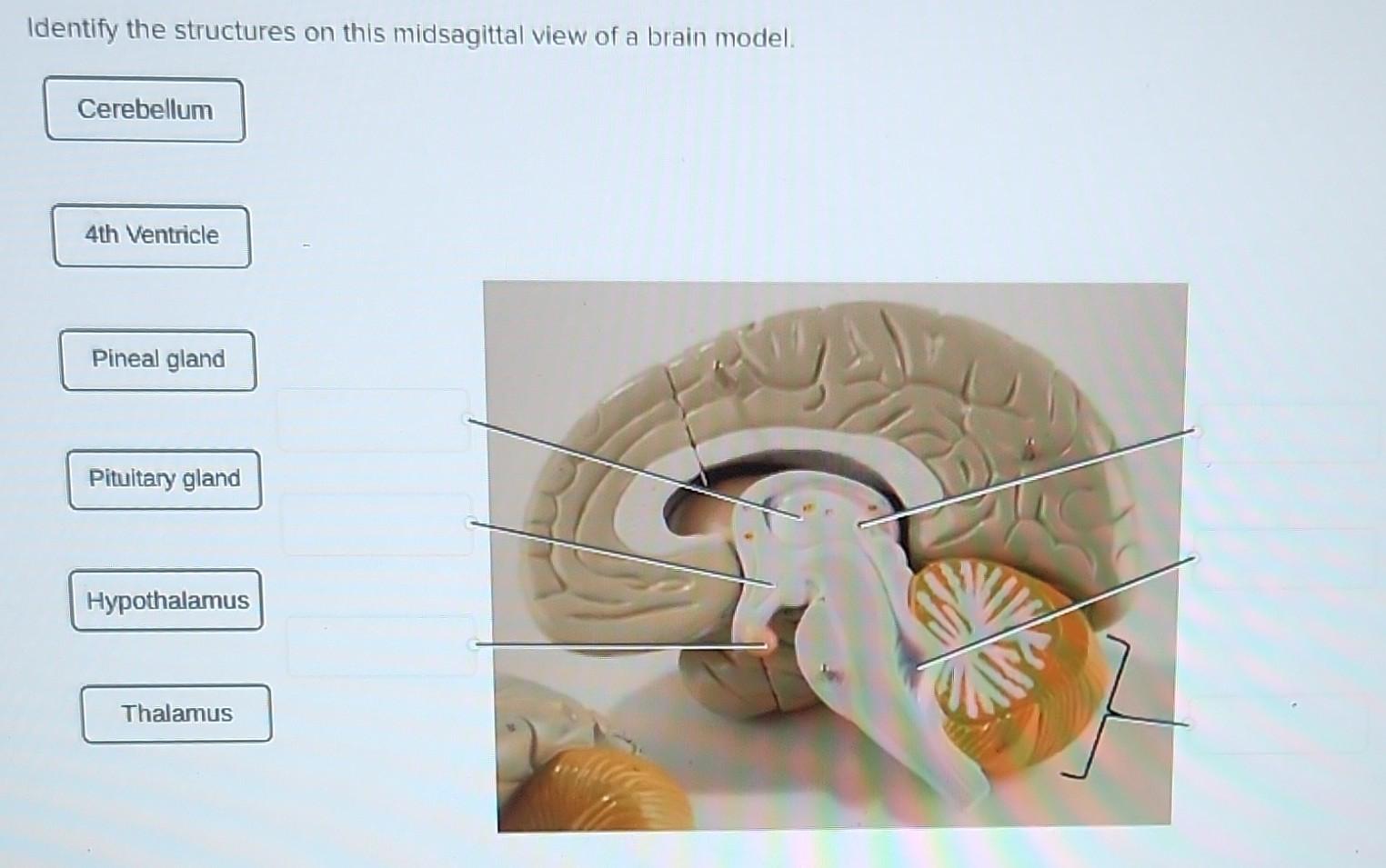 Solved Identify The Structures This Midsagittal View - vrogue.co Solved Identify The Structures This Midsagittal View - vrogue.co