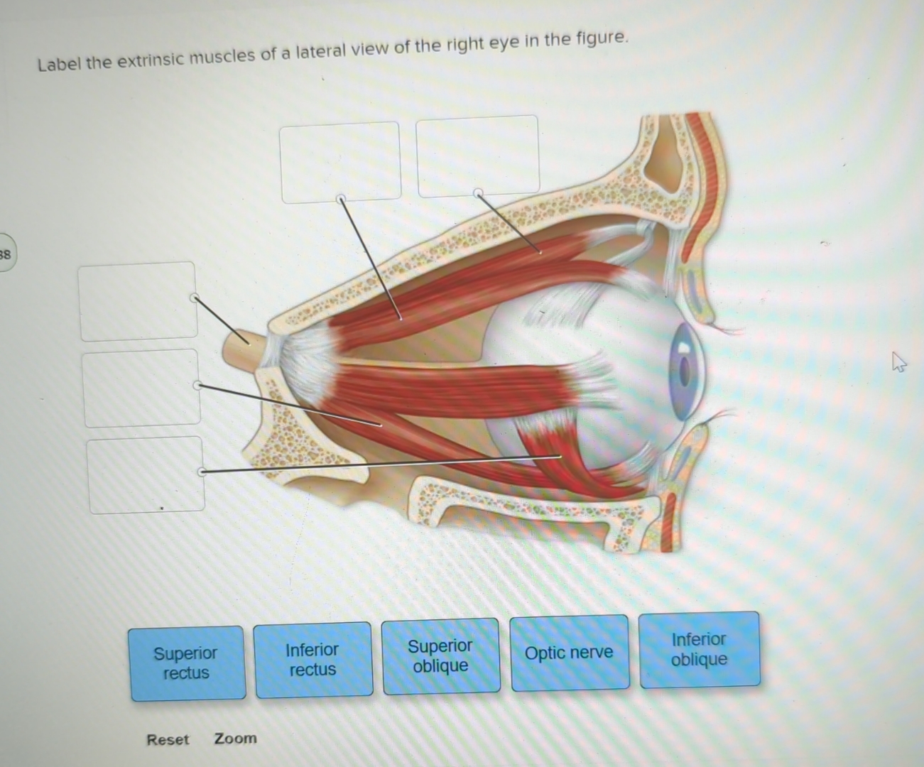Solved Label the extrinsic muscles of a lateral view of the | Chegg.com