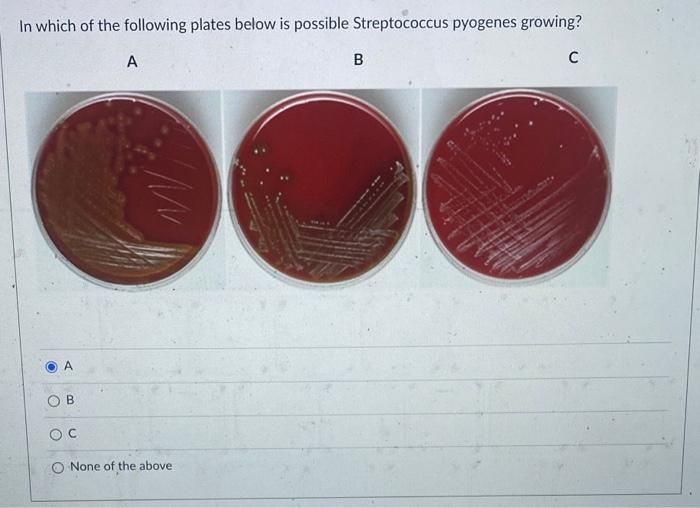 Solved In which of the following plates below is possible | Chegg.com