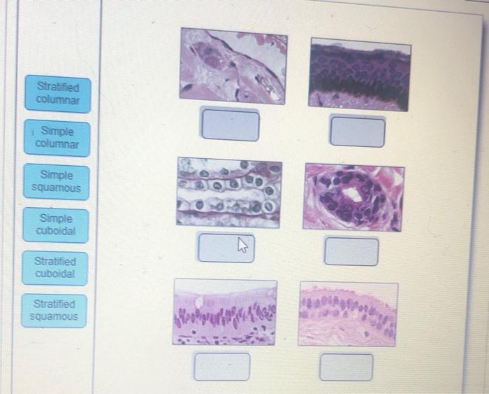 Solved Stratified columnar Simple columnar Simple squamous | Chegg.com