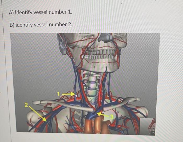 Solved A) Identify vessel number 1. B) Identify vessel | Chegg.com | Chegg.com