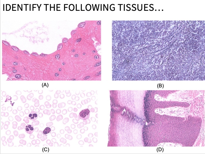 Solved IDENTIFY THE FOLLOWING TISSUES... f (A) (B) (C) (0) | Chegg.com