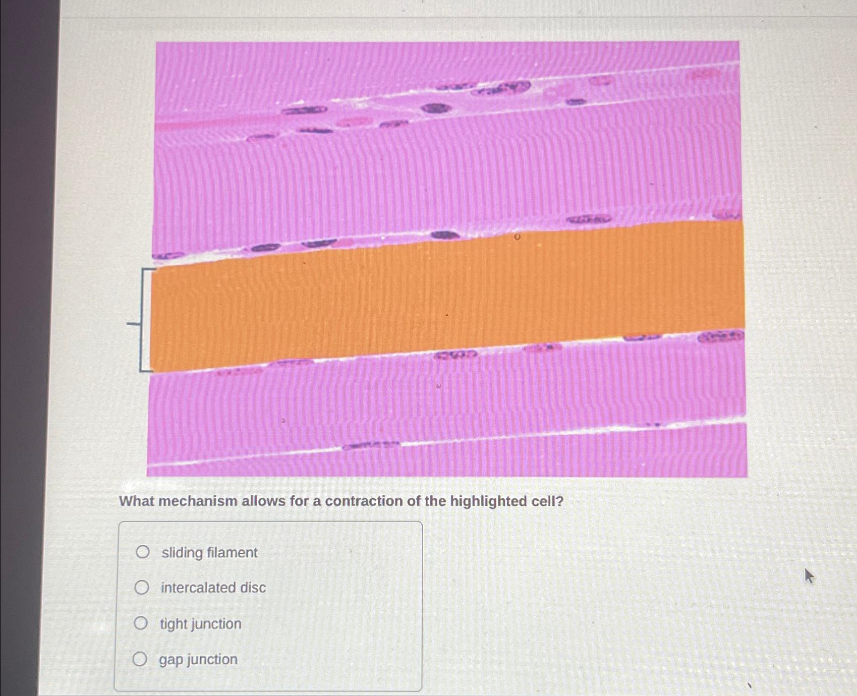 Solved What mechanism allows for a contraction of the | Chegg.com