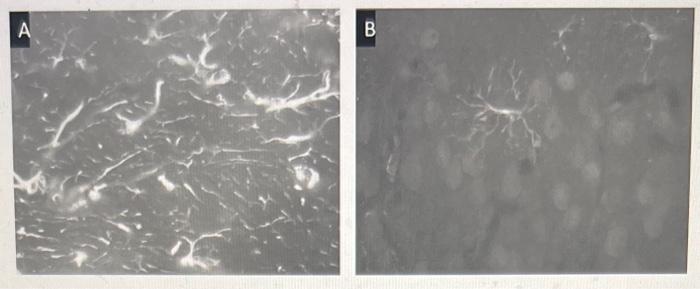 Solved These are two inages taken fron different structures | Chegg.com