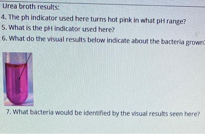 Solved Urea broth results: 4. The ph indicator used here | Chegg.com