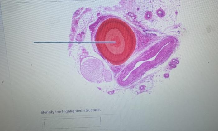 Solved Identify the highlighted structure. | Chegg.com
