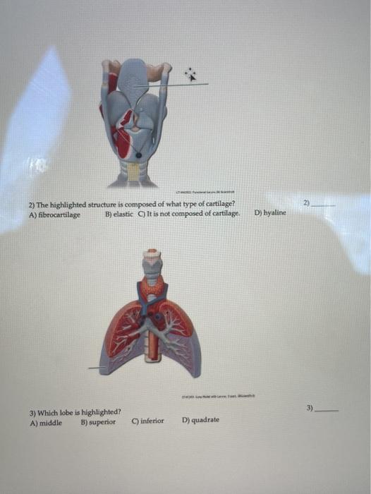 Solved 2) 2) The highlighted structure is composed of what | Chegg.com