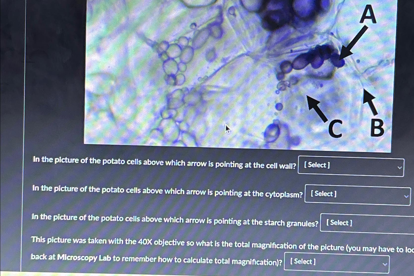 Solved In the picture of the potato cells above which arrow | Chegg.com