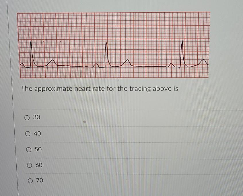 Solved The approximate heart rate for the tracing above is O | Chegg.com