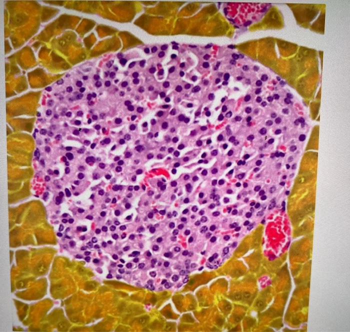 Solved Whats highlighted?dorsal artery, lateral malleolar | Chegg.com