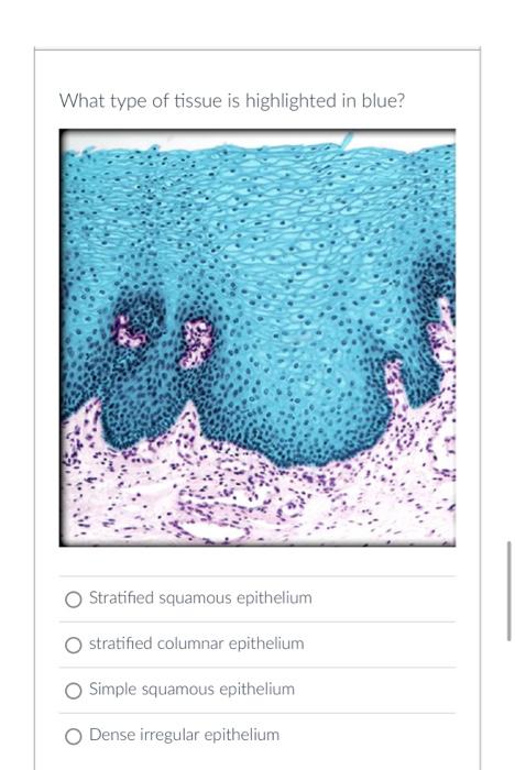 Solved What type of tissue is highlighted in blue? | Chegg.com