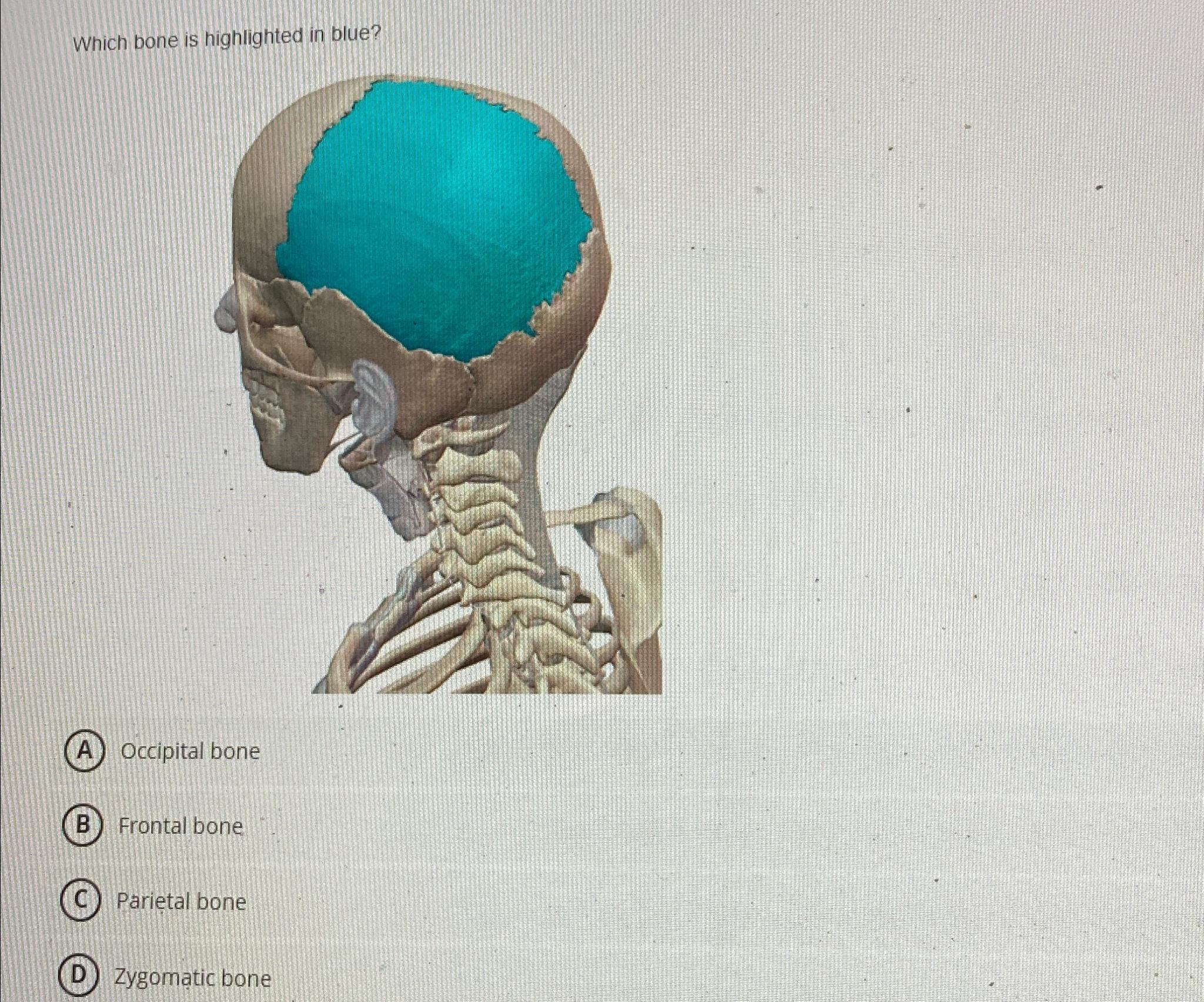 Solved Which bone is highlighted in blue?Occipital | Chegg.com