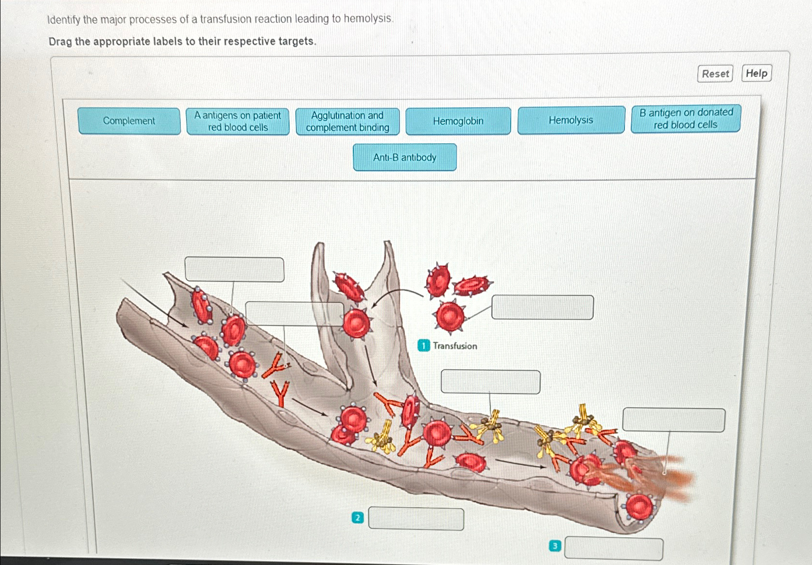 Solved Identify the major processes of a transfusion | Chegg.com