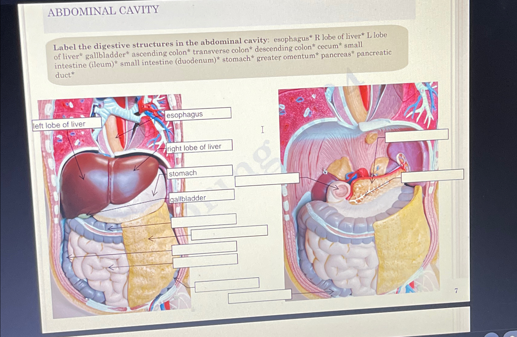Solved ABDOMINAL CAVITYLabel the digestive structures in the | Chegg.com