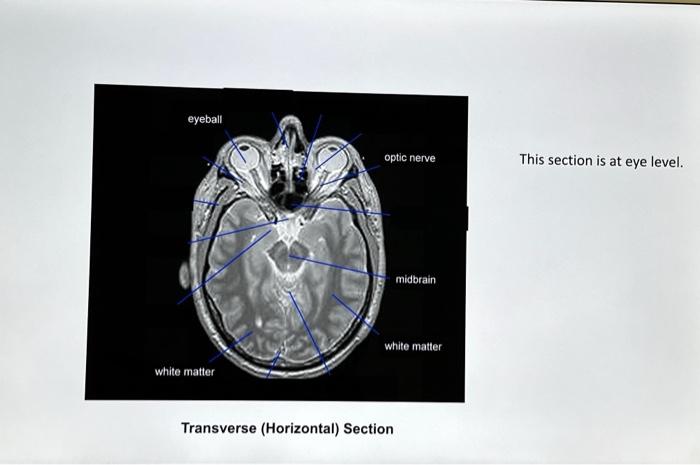 Solved This section is at eye level. Transverse (Horizontal) | Chegg.com