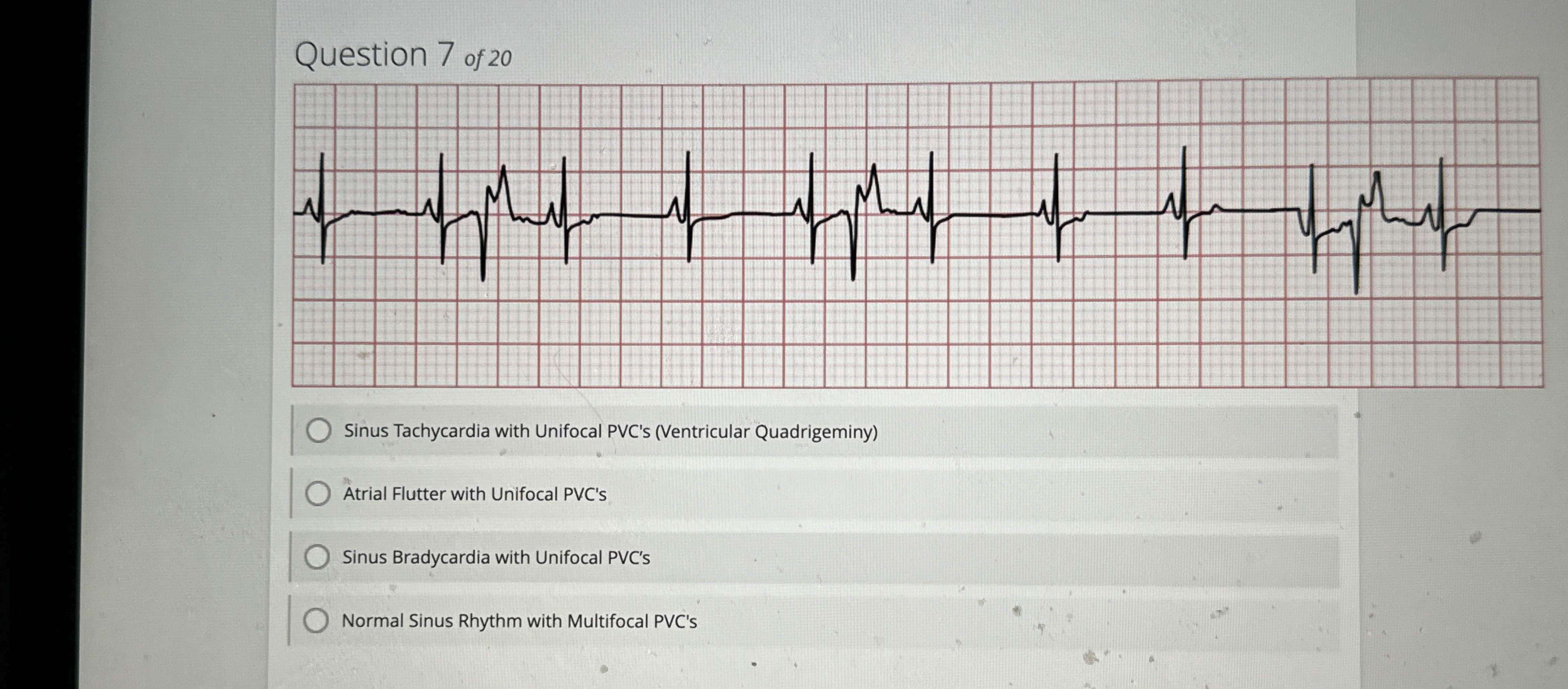 Solved Question 7 ﻿of 20 ﻿What rhythm is displayed | Chegg.com