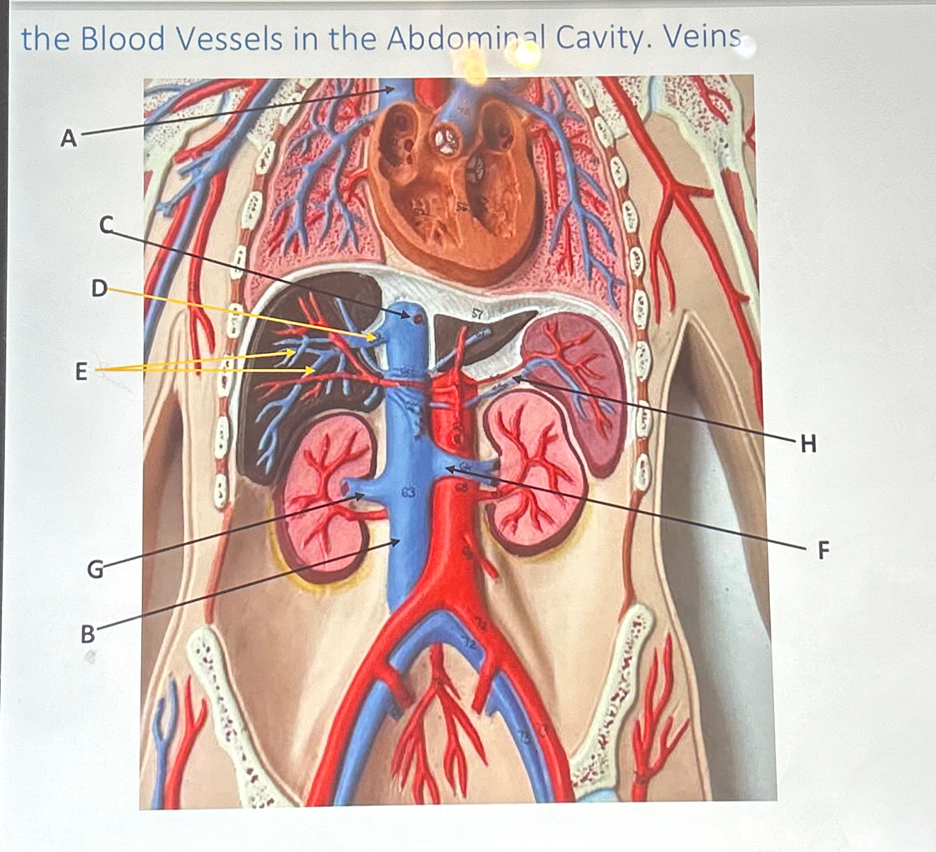 Solved the Blood Vessels in the Abdominal Cavity. Veins | Chegg.com